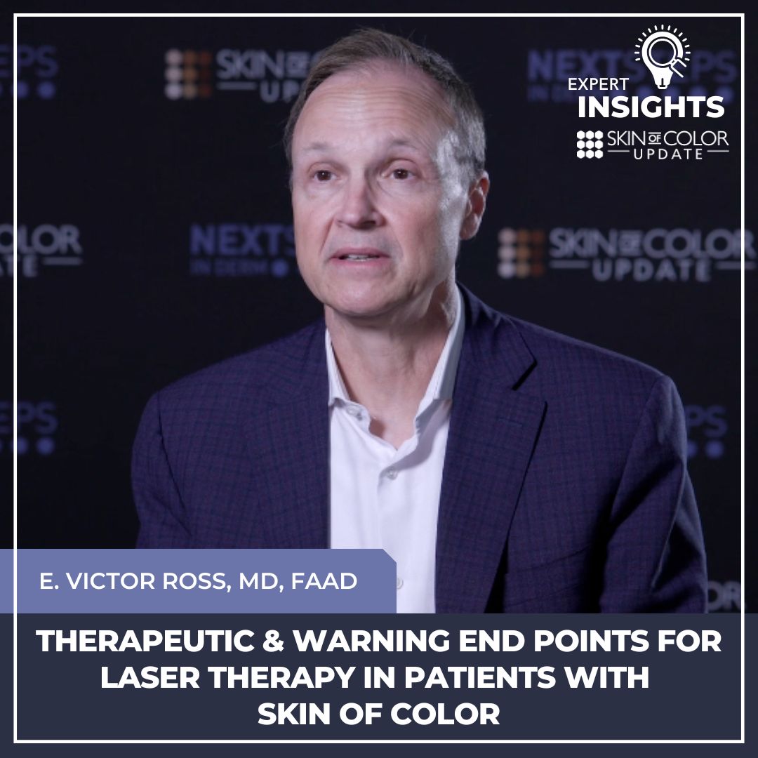 Laser End Points at SOCU with E. Victor Ross, MD | Skin of Color Update ...