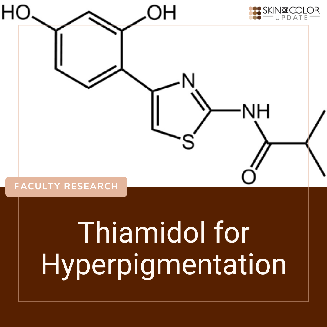 SOCU Faculty Research: Thiamidol for Hyperpigmentation | Skin of Color ...