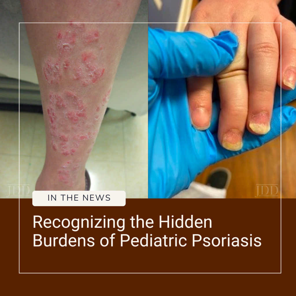 GLP-1 agonists in dermatology Archives | Skin of Color Update ...