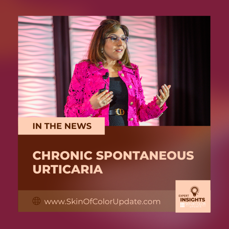 SOCU in the News: Chronic Spontaneous Urticaria | Skin of Color Update ...